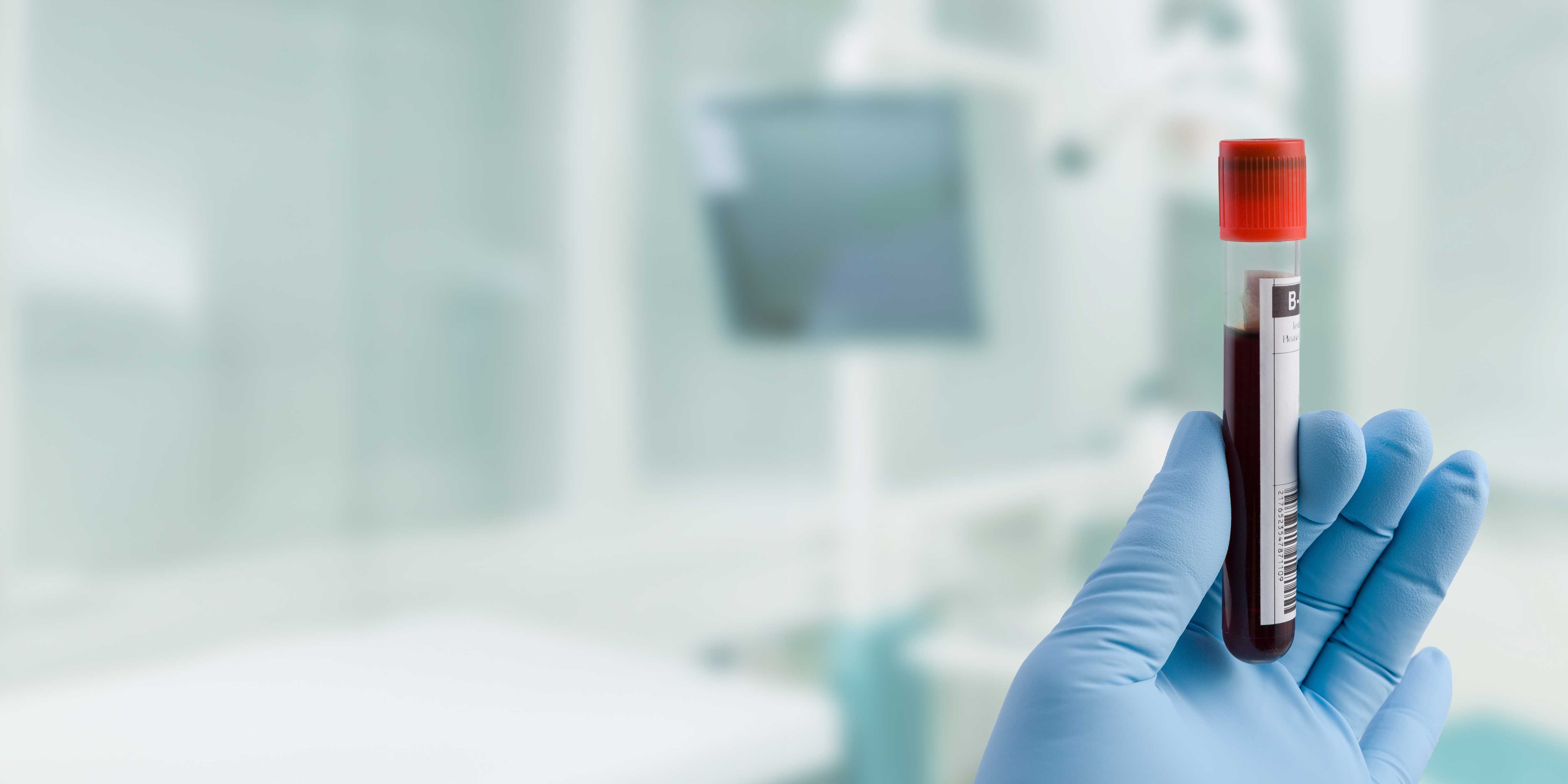 Erfolgsgeschichten - Computergenerierte Diagnosen für Biovis